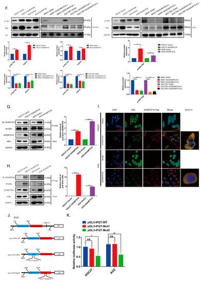 The Novel Protein ADAMTS16 Promotes Gastric Carcinogenesis by Targeting ...