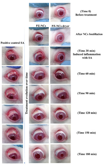 Assessment of Efficacy and Safety Using PPAR-γ Agonist-Loaded ...