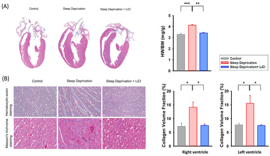 IJMS | Free Full-Text | Lithium Treatment Improves Cardiac Dysfunction ...