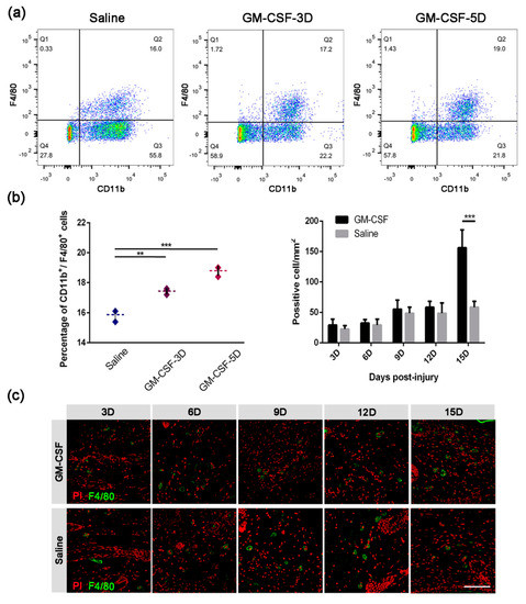 The Stimulation of Macrophages by Systematical Administration of GM-CSF ...