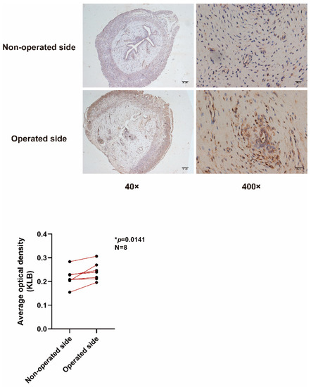 β-Klotho Promotes the Development of Intrauterine Adhesions via the ...