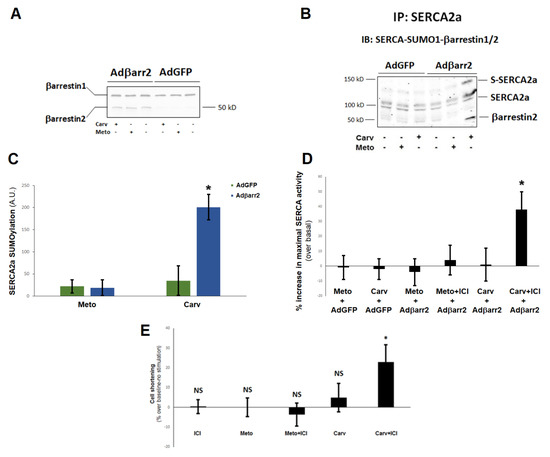 Carvedilol Selectively Stimulates βArrestin2-Dependent SERCA2a Activity ...