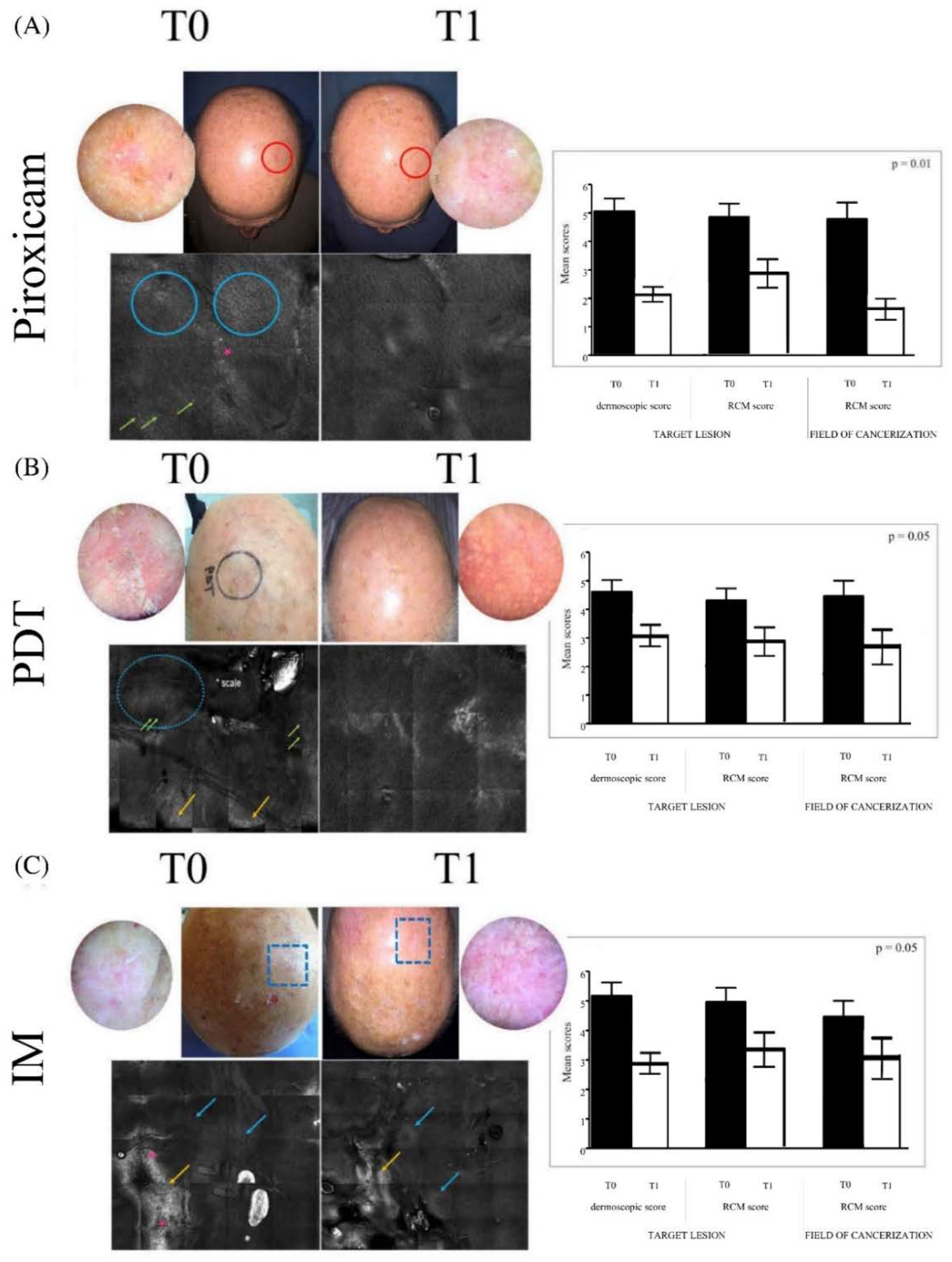 Ijms Free Full Text Topical Treatment Of Actinic Keratosis And