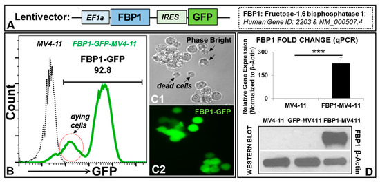 FBP1-Altered Carbohydrate Metabolism Reduces Leukemic Viability through ...