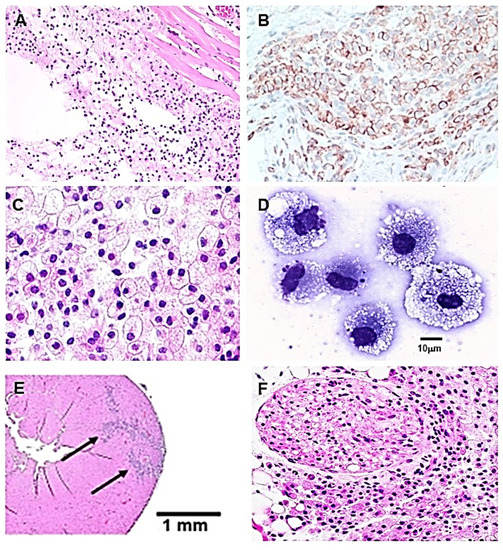 α-Gal Nanoparticles Mediated Homing of Endogenous Stem Cells for Repair ...