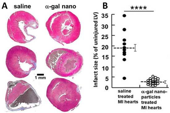 α-Gal Nanoparticles Mediated Homing of Endogenous Stem Cells for Repair ...