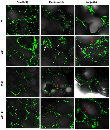 Study on βTCP/P(3HB) Scaffolds—Physicochemical Properties and ...