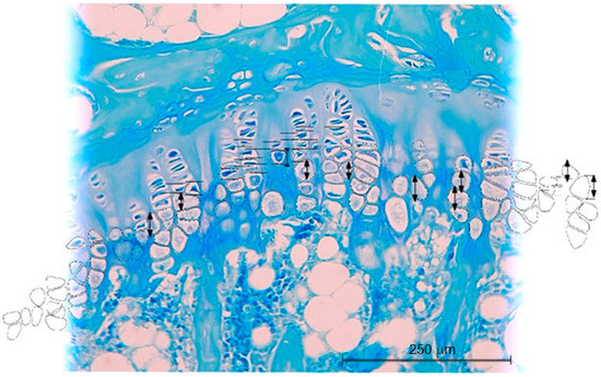 Reactivation of Vertebral Growth Plate Function in Vertebral Body ...