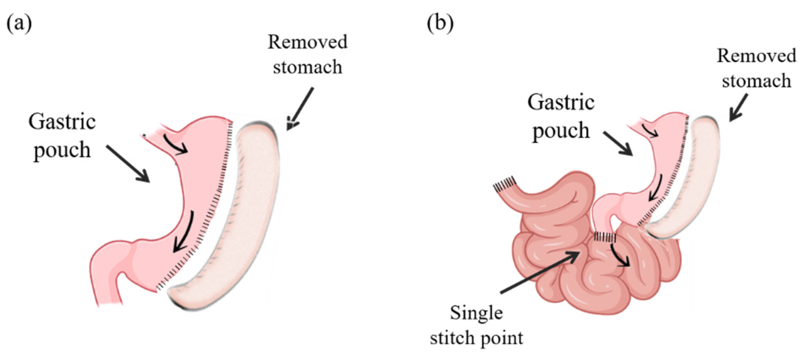 Ijms Free Full Text Improved Adipose Tissue Function After Single
