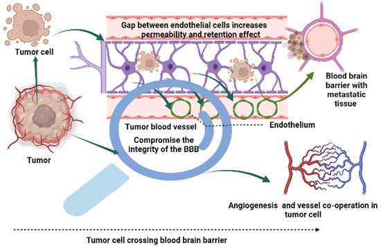 An Insight into Molecular Targets of Breast Cancer Brain Metastasis