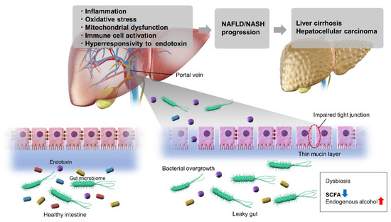 Current Research on the Pathogenesis of NAFLD/NASH and the Gut–Liver ...