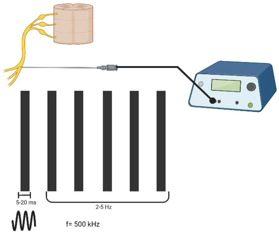 The Mechanism of Action between Pulsed Radiofrequency and ...