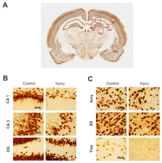 Experimental and Clinical Biomarkers for Progressive Evaluation of ...