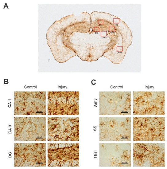 Experimental and Clinical Biomarkers for Progressive Evaluation of Neuropathology and ...