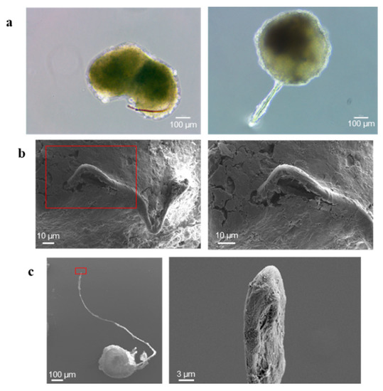Cancer Three-Dimensional Spheroids Mimic In Vivo Tumor Features ...