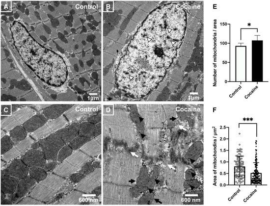Contraction Band Necrosis with Dephosphorylated Connexin 43 in Rat ...