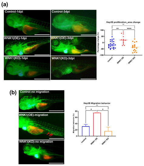 WNK1–OSR1 Signaling Regulates Angiogenesis-Mediated Metastasis towards ...