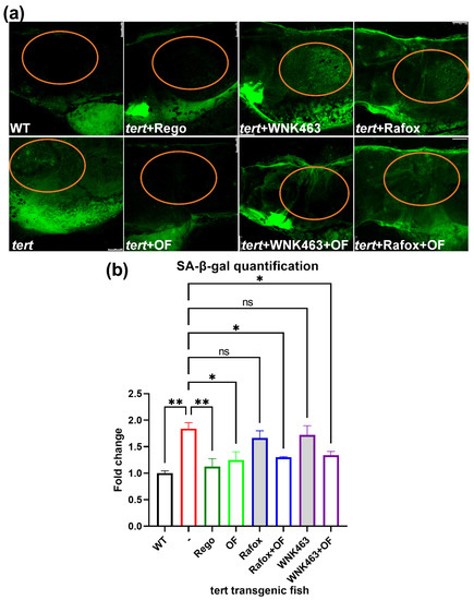 WNK1–OSR1 Signaling Regulates Angiogenesis-Mediated Metastasis towards ...