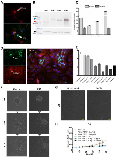IJMS | Free Full-Text | Phenotypical Flexibility of the EGFRvIII ...