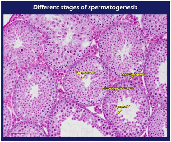 Testis Slide Interstitial Cells