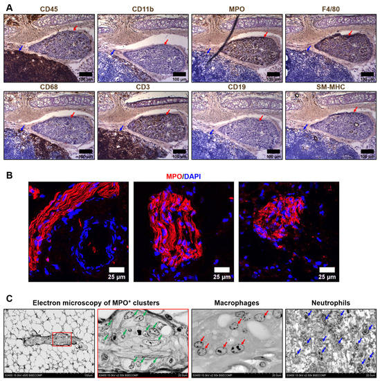 Excessive Adventitial and Perivascular Vascularisation Correlates with ...