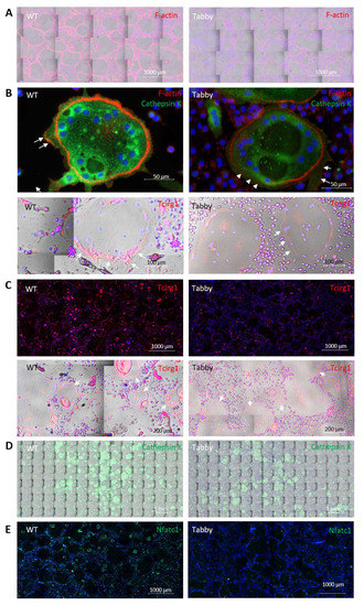 Ectodysplasin A1 Deficiency Leads to Osteopetrosis-like Changes in ...