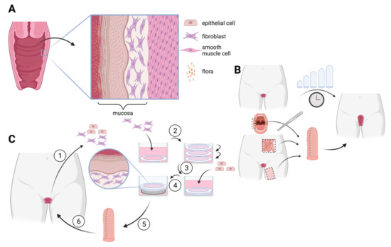 Tissue Engineering in Gynecology