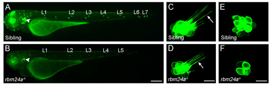 Emerging Roles of RNA-Binding Proteins in Inner Ear Hair Cell ...