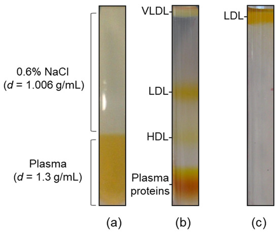 Molecular Characterization of Plasma HDL, LDL, and VLDL Lipids Cargos ...