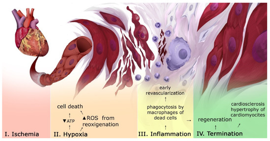The Role of the Notch Signaling Pathway in Recovery of Cardiac Function ...
