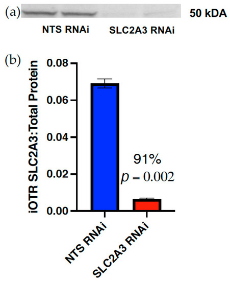 IJMS | Free Full-Text | Impact of Placental SLC2A3 Deficiency during ...