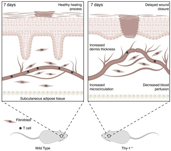 IJMS | Special Issue : Wound Healing and Hypertrophic Scar