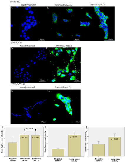 Development of a Method for Producing oxLDL: Characterization of Their ...