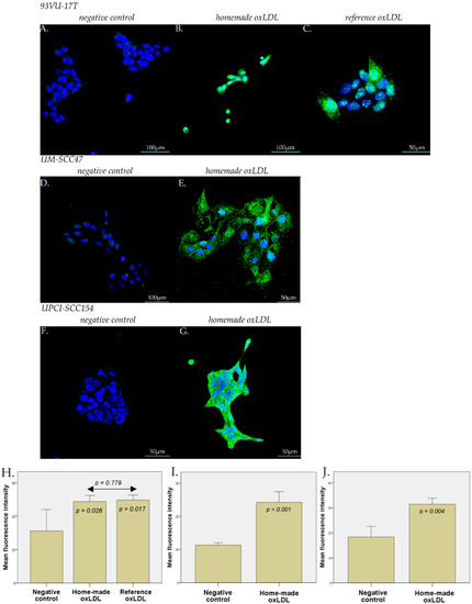 Development of a Method for Producing oxLDL: Characterization of Their ...