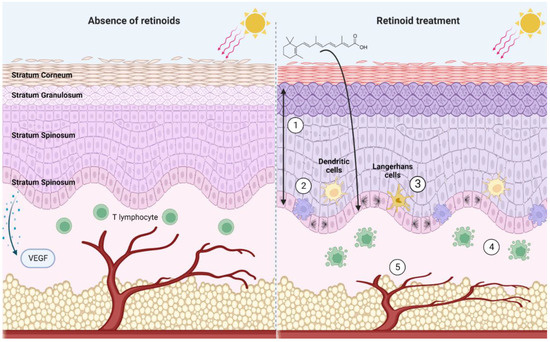 The Use of Retinoids for the Prevention and Treatment of Skin Cancers ...