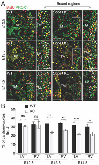 Ijms Free Full Text Ccbe1 Is Essential For Epicardial Function