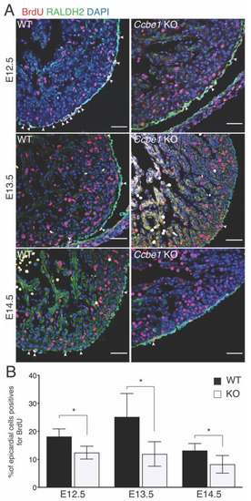 Ijms Free Full Text Ccbe1 Is Essential For Epicardial Function