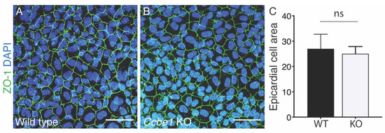 Ijms Free Full Text Ccbe1 Is Essential For Epicardial Function