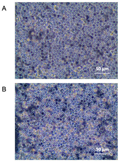 IJMS | Free Full-Text | Upgrading Monocytes Therapy for Critical Limb ...