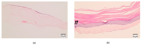 Exploring the Concept of In Vivo Guided Tissue Engineering by a Single ...