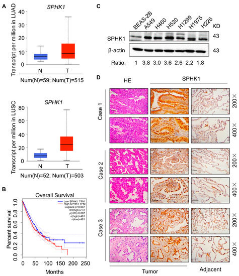 IJMS | Free Full-Text | Targeting SPHK1/PBX1 Axis Induced Cell Cycle ...