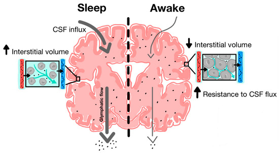 Glymphatic System Dysfunction and Sleep Disturbance May Contribute to ...