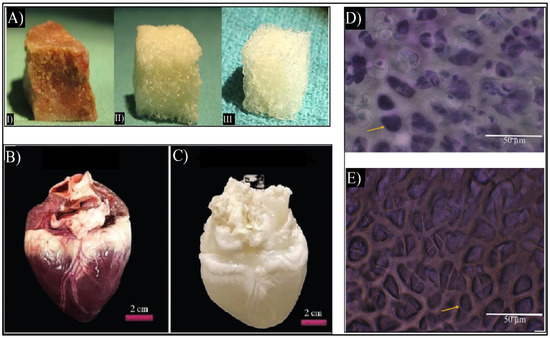Decellularized Extracellular Matrix-Based Bioinks for Tendon ...