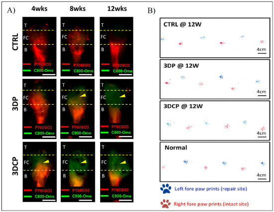 Decellularized Extracellular Matrix-Based Bioinks for Tendon Regeneration in Three-Dimensional ...
