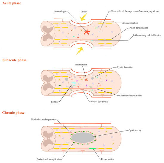 Stem Cell Strategies in Promoting Neuronal Regeneration after Spinal ...