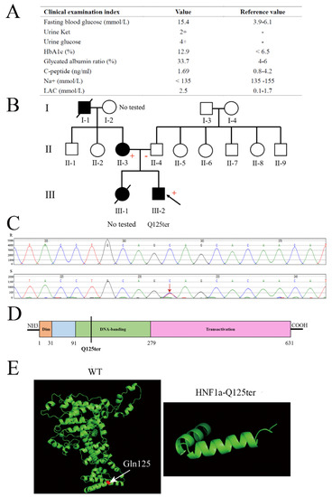Novel Loss-of-Function Variant in HNF1a Induces β-Cell Dysfunction through Endoplasmic Reticulum ...