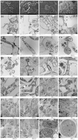 Ontogenetic Variation in Macrocyclic and Hemicyclic Poplar Rust Fungi