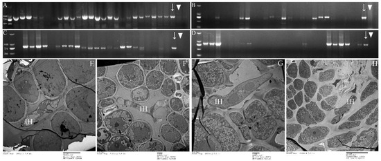 Ontogenetic Variation in Macrocyclic and Hemicyclic Poplar Rust Fungi