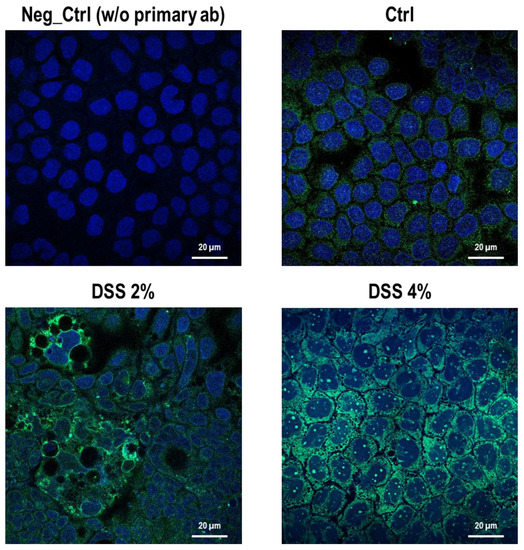 Identification of SLC15A4/PHT1 Gene Products Upregulation Marking the ...