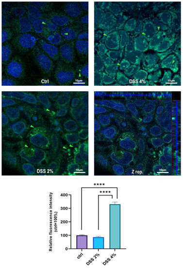 Identification of SLC15A4/PHT1 Gene Products Upregulation Marking the ...